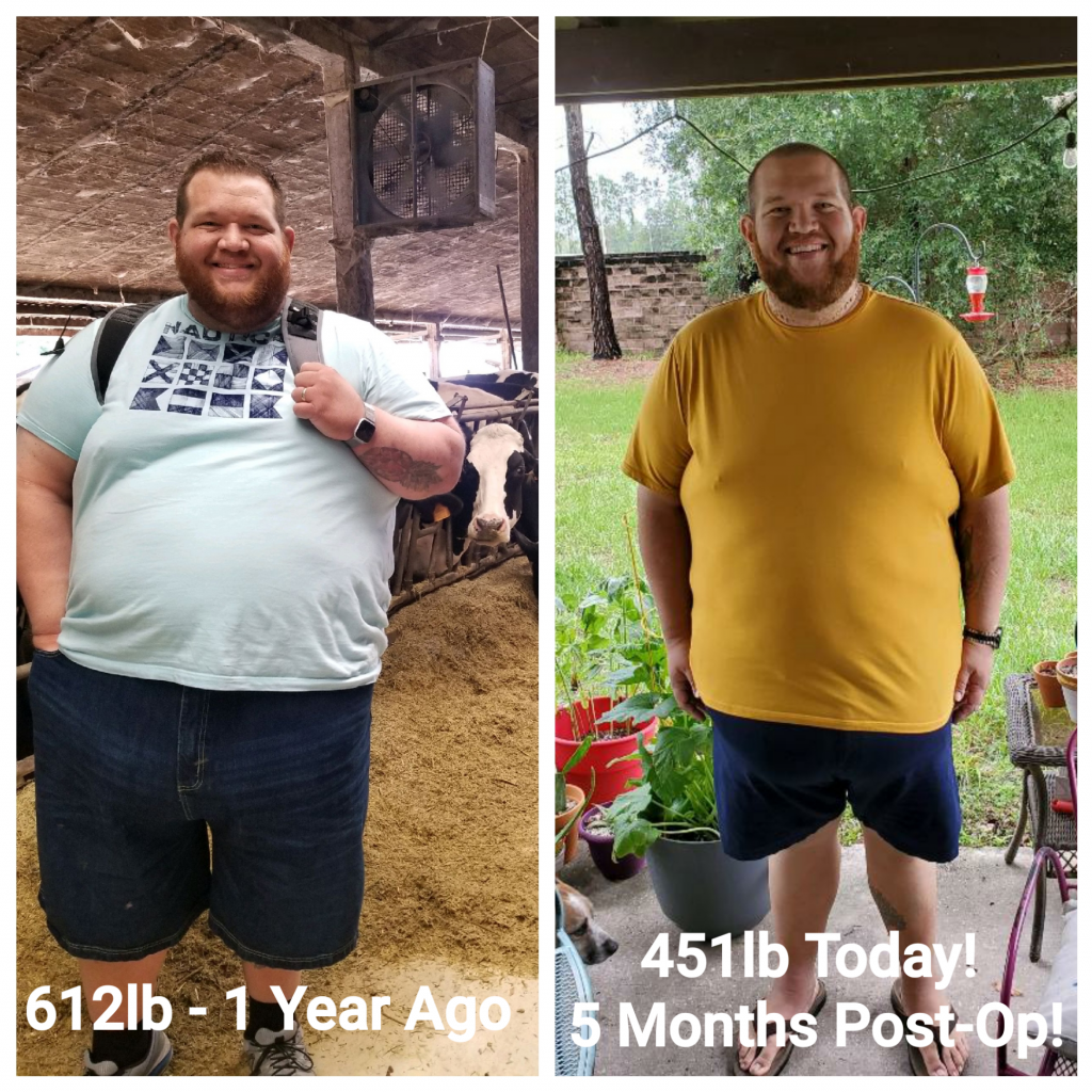 TGH + USF Health Bariatric Center Provides A New Lease On Life For ...